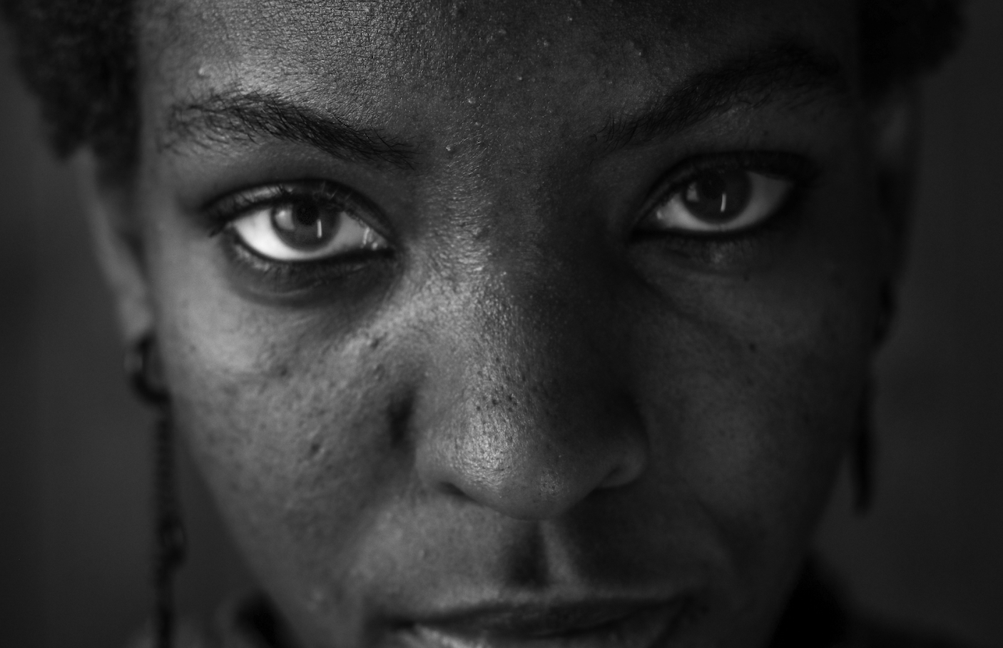 Clearing the Path: An Easy Skincare Routine for Acne-Prone Skin – Yendy ...